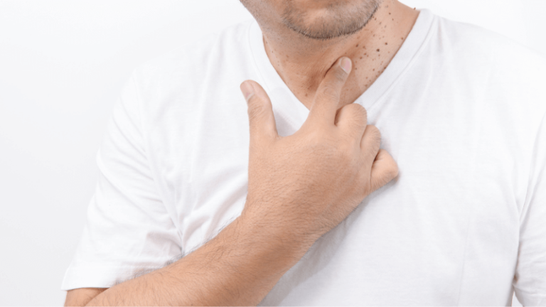 Fibromi penduli: cosa sono, come si formano e come eliminarli ...